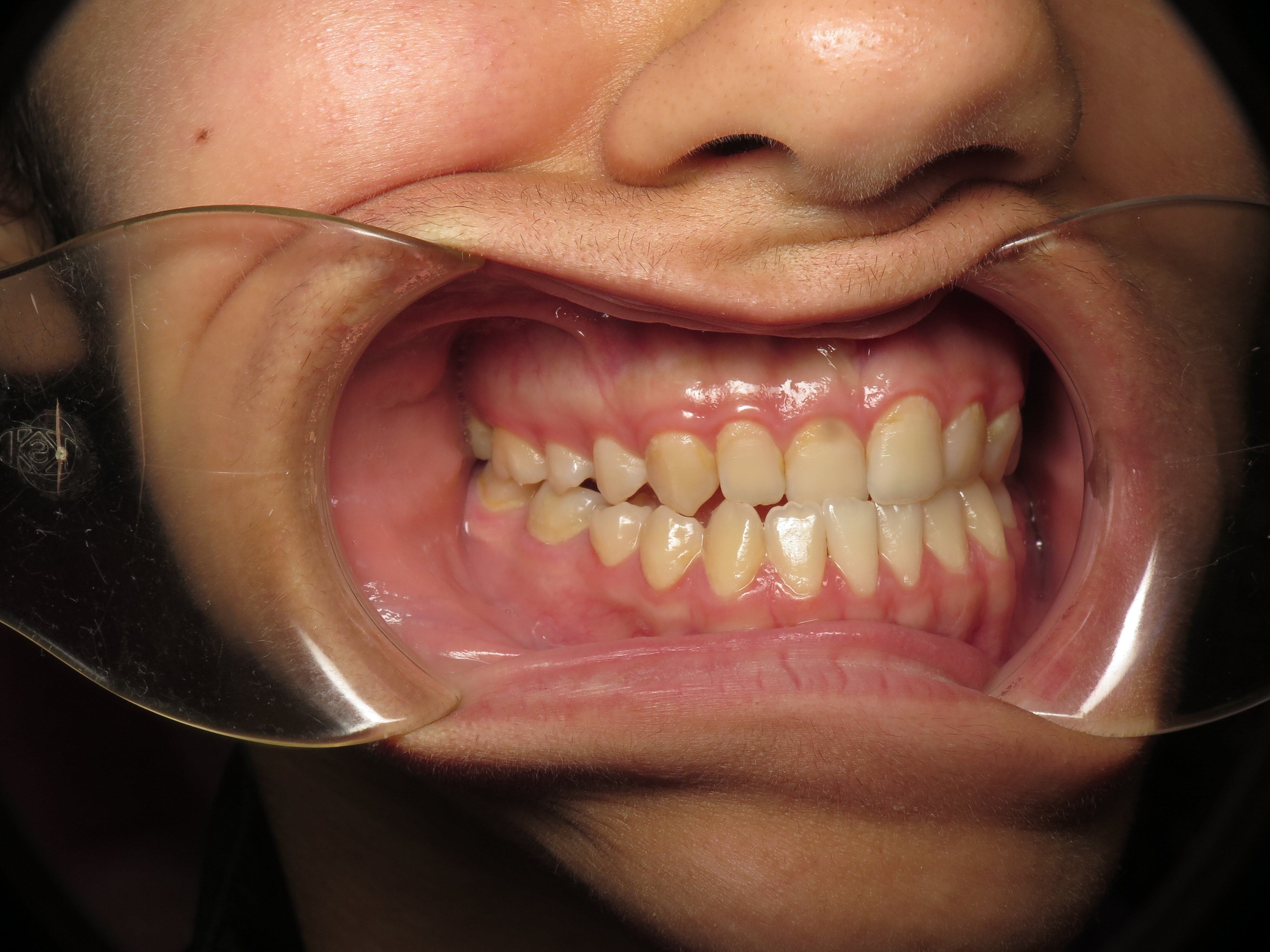 Gallery | Orthodontist in North San Antonio, TX
